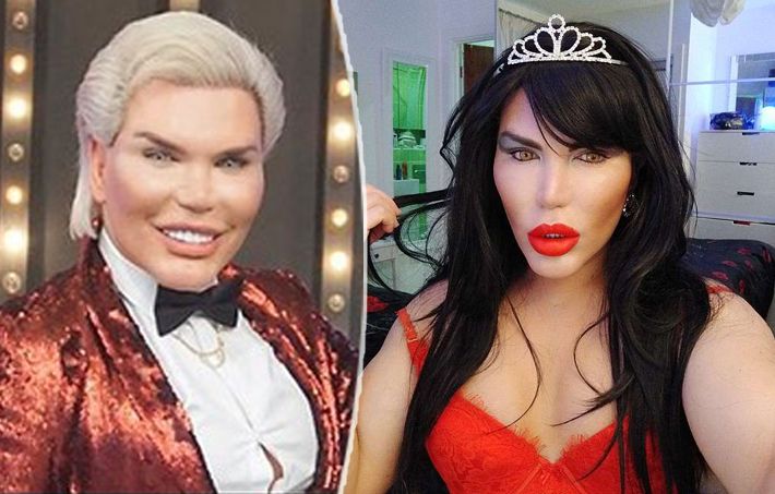 Rodrigo Alves: chi è, età, interventi e curiosità sul "Ken Umano"- "Barbie"